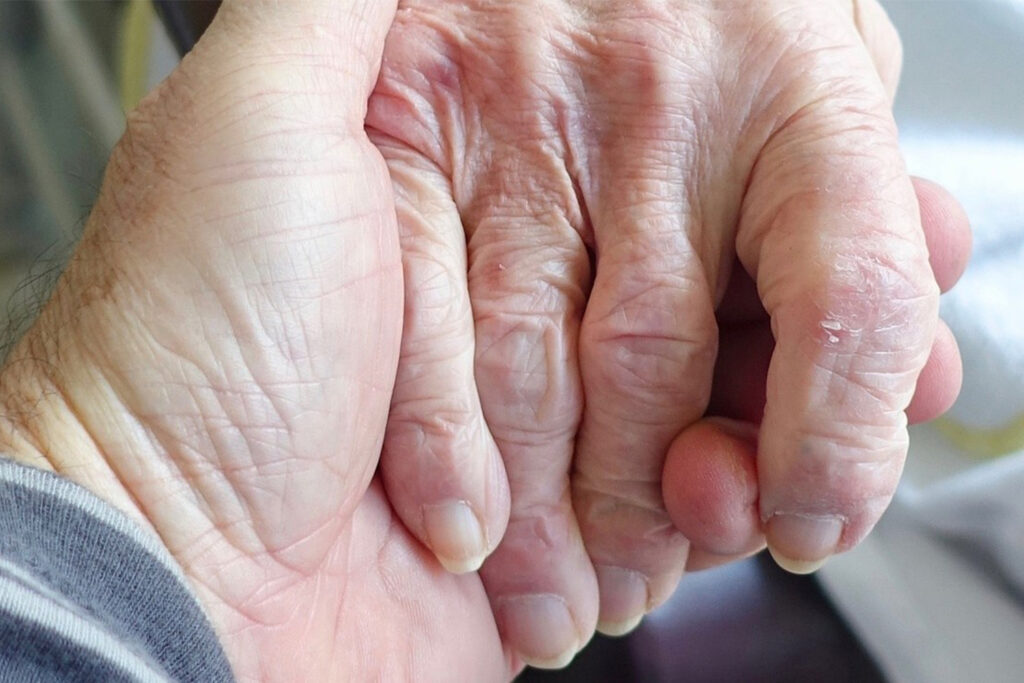 Dekubitus Grad 4 – Definition, Beschreibung und Behandlung